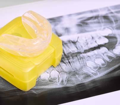 Advanced Open Bite Correction from Pristyn Care Orthodontists