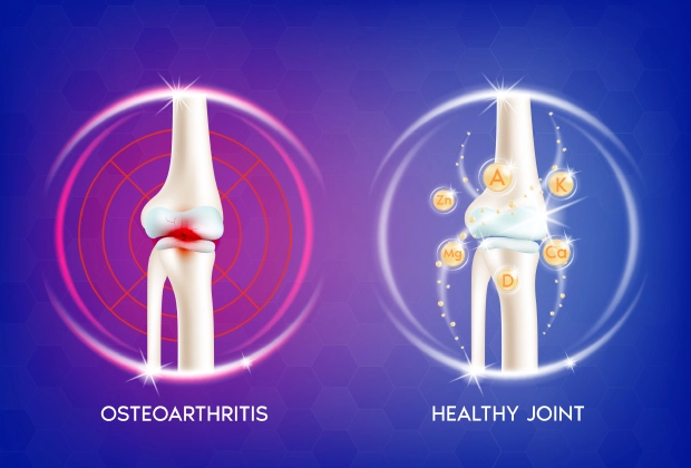 Phimosis Treatment - Diagnosis, Surgery, Creams & Recovery