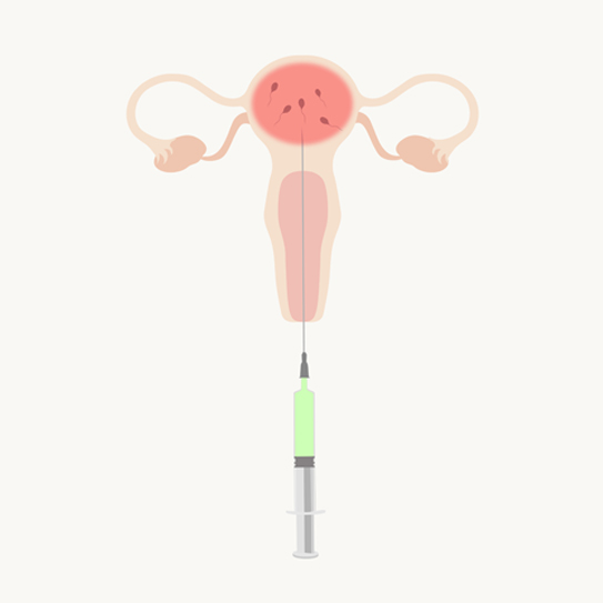 Top 60 + Iui video animation - Lifewithvernonhoward.com